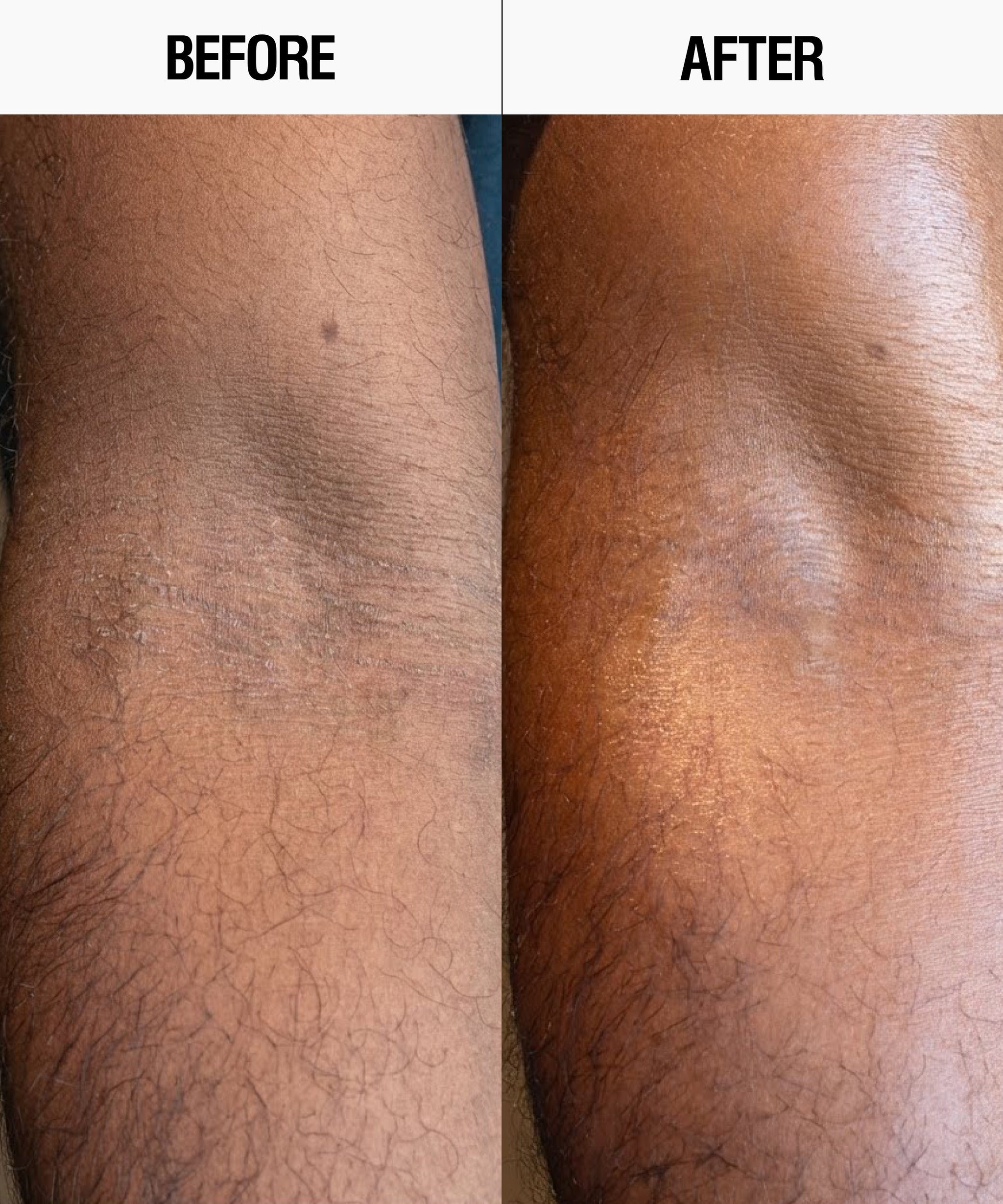 Resurfacing Body Lotion - 50mL – Grown Alchemist